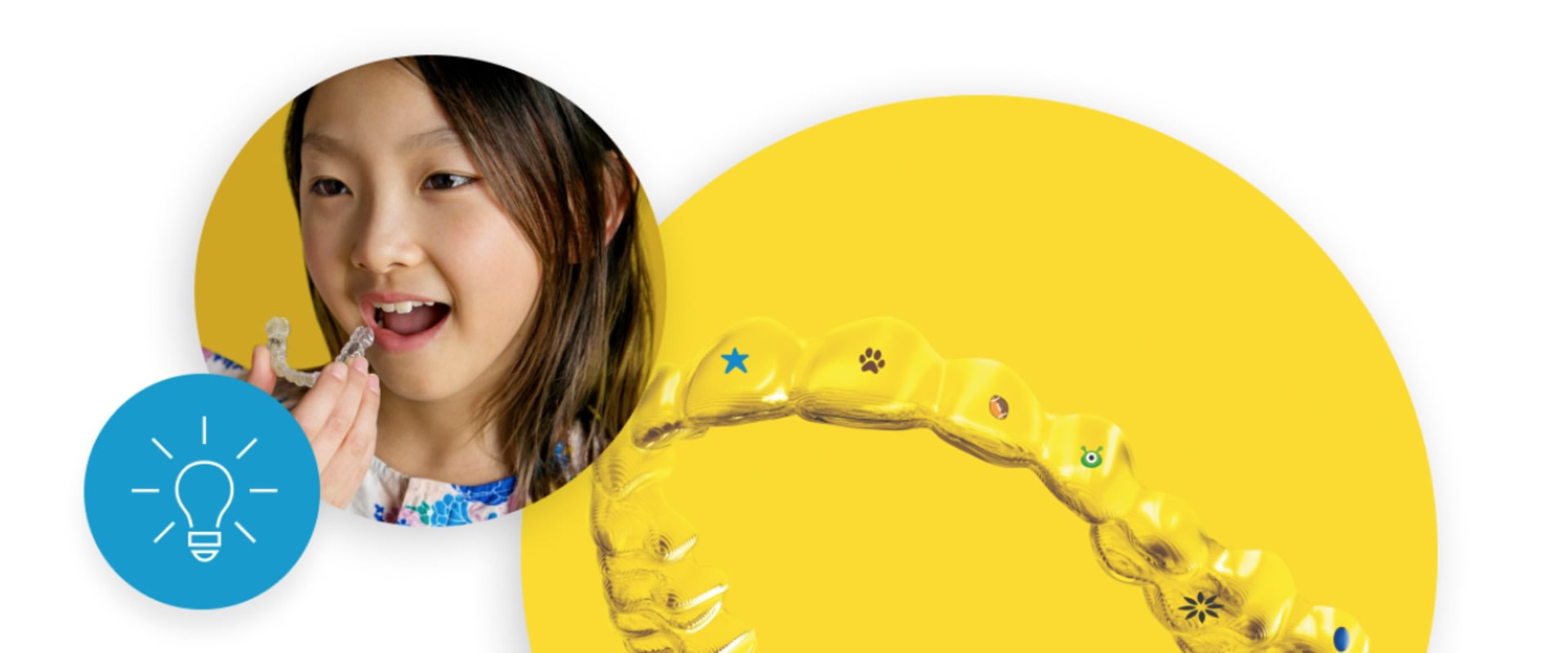 What is the First Step for Invisalign Treatment?