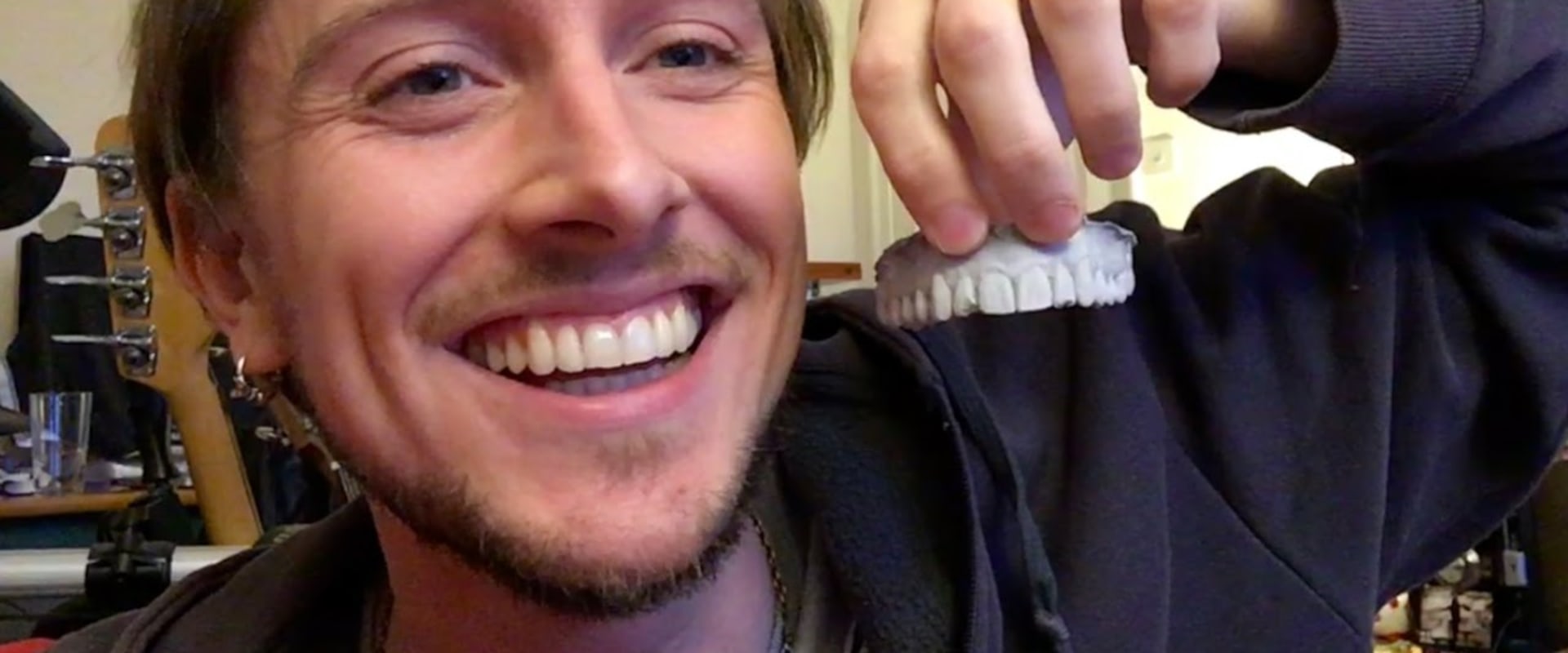 Do I Need to Wear a Retainer After My Invisalign Treatment is Complete?